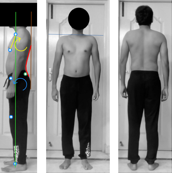 Posture assessment: False_Room | Good Posture Studio Posture assessment: False_Room | Good Posture Studio